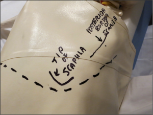 Lesson 8. Performance of a Left Postero-Lateral Thoracotomy | Thoracic ...